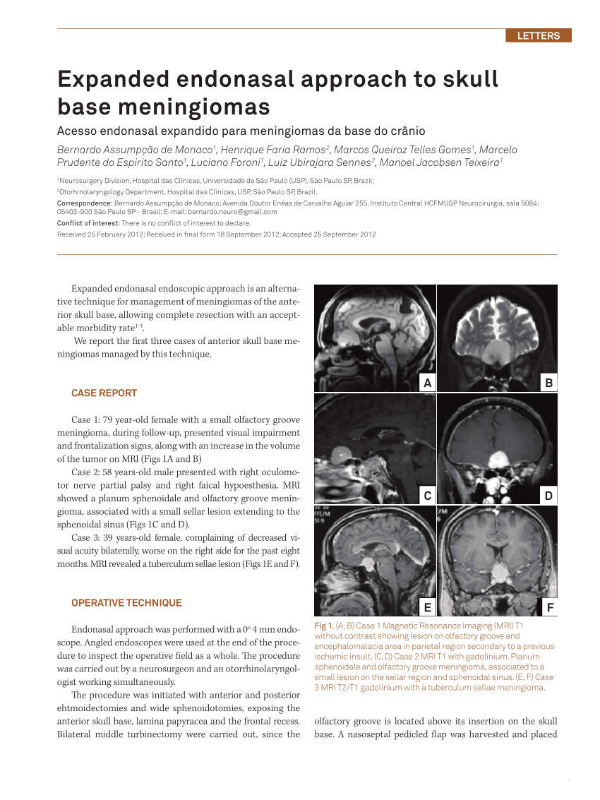 Expanded endonasal approach to skull base meningiomas
